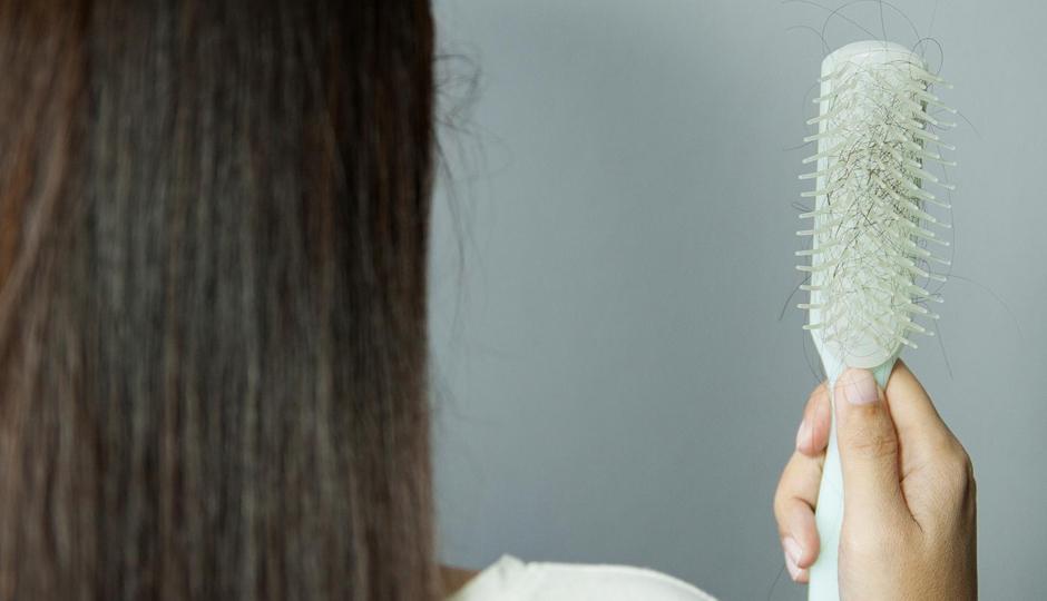 Hair Shedding: Telogen Effluvium or Androgenetic Alopecia?